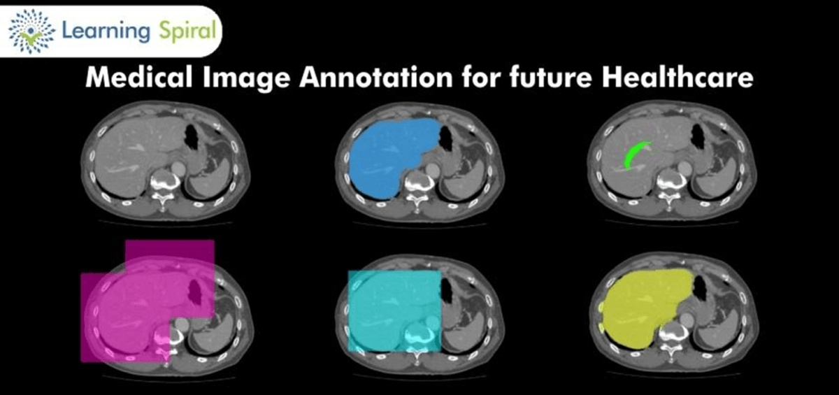Medical Image Annotation Services at Amelia Rodrigues blog